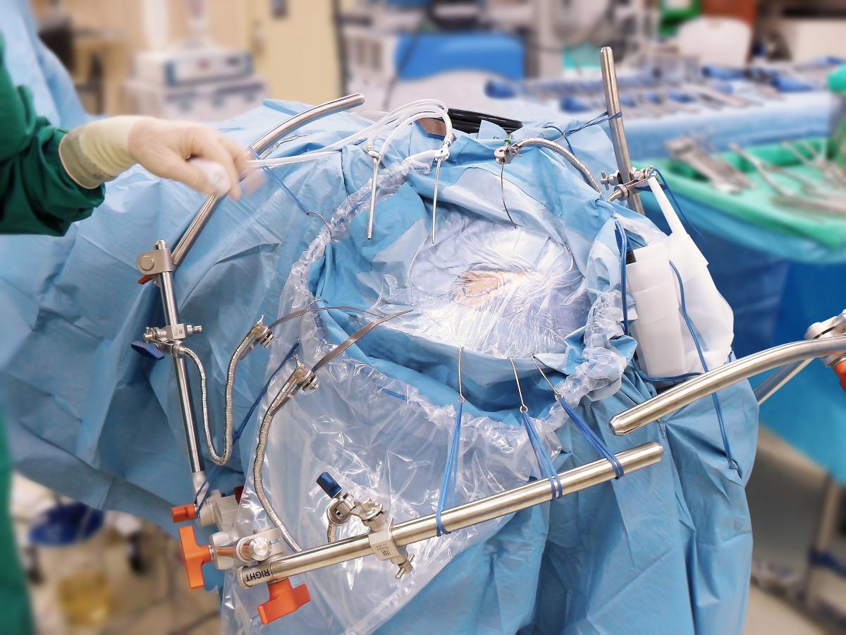 Fukushima brain surgery retraction system | Conecto Medical